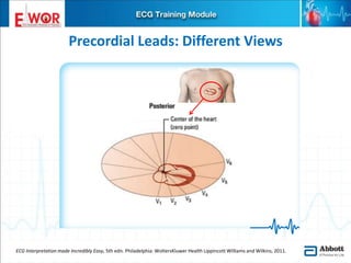 Ecg basics and interpretation | PPTX