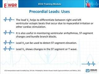 Ecg basics and interpretation | PPTX