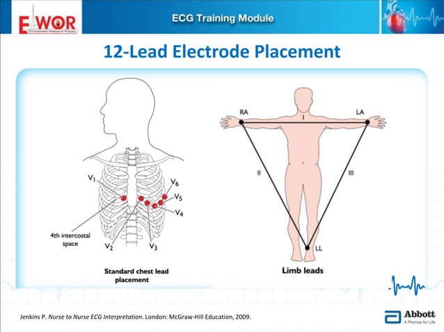 Ecg basics and interpretation | PPTX