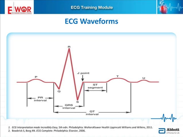 Ecg basics and interpretation | PPTX