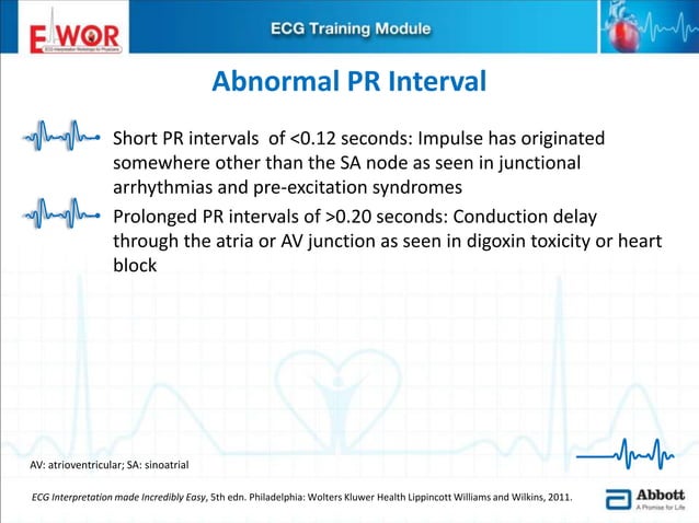Ecg basics and interpretation | PPTX