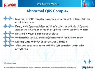 Ecg basics and interpretation | PPTX