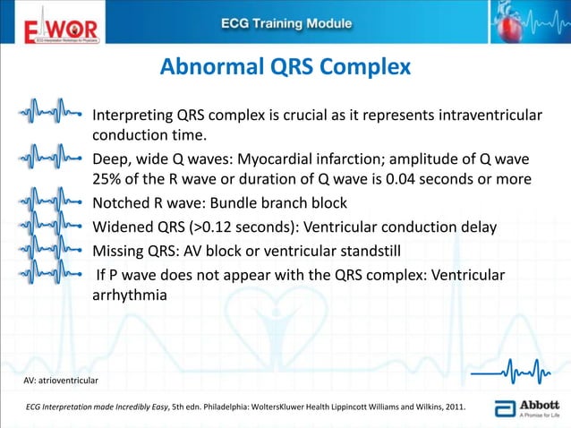 Ecg basics and interpretation | PPTX