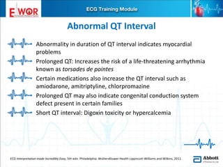 Ecg basics and interpretation | PPTX