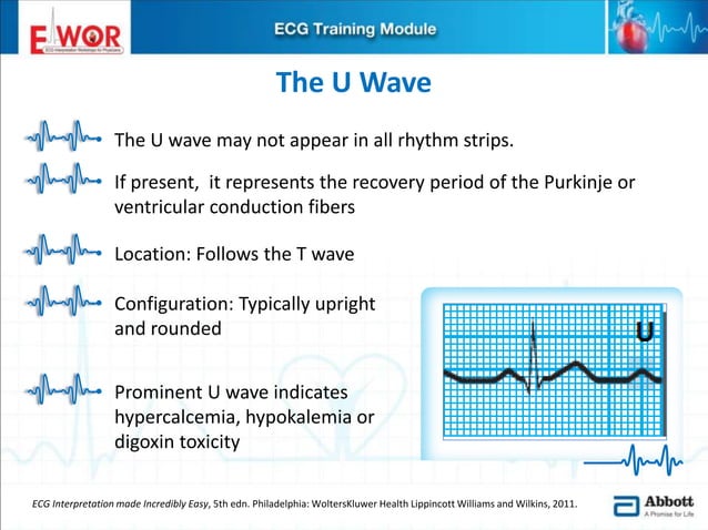 Ecg basics and interpretation | PPTX