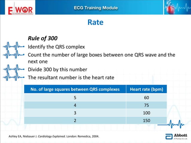 Ecg basics and interpretation | PPTX