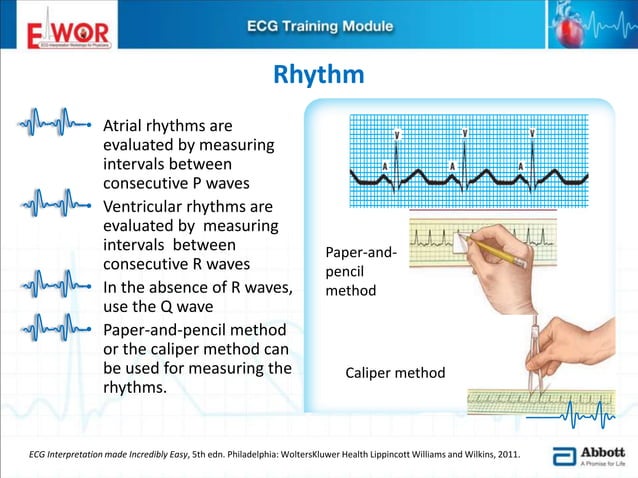 Ecg basics and interpretation | PPTX