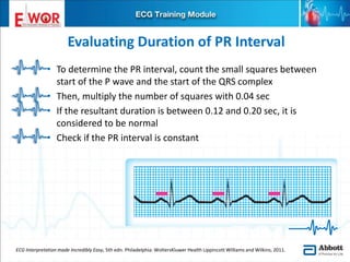 Ecg basics and interpretation | PPTX