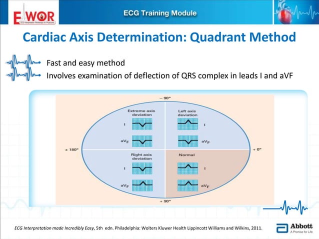 Ecg basics and interpretation | PPTX