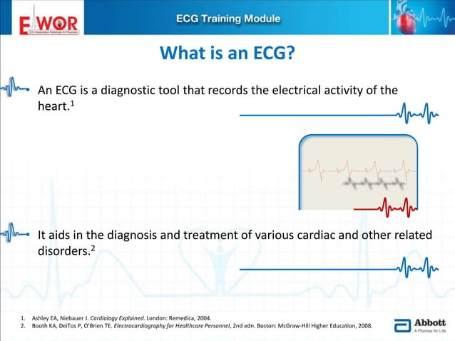 Ecg basics and interpretation | PPTX
