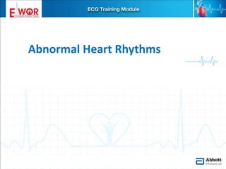 Ecg basics and interpretation | PPTX