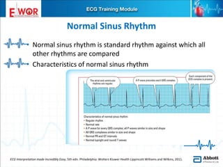 Ecg basics and interpretation | PPTX