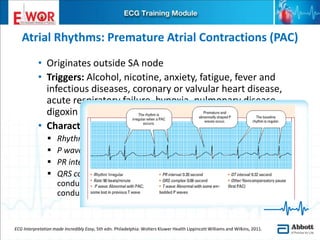 Ecg basics and interpretation | PPTX