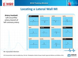 Ecg basics and interpretation | PPTX
