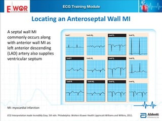 Ecg basics and interpretation | PPTX
