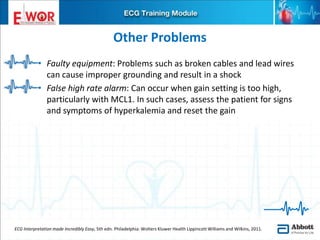 Ecg basics and interpretation | PPTX