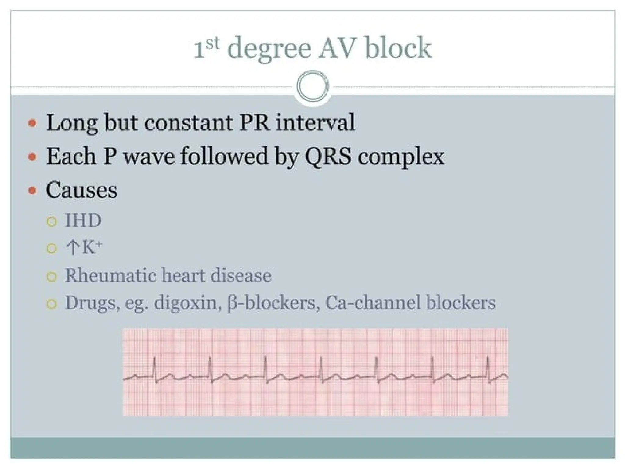 ECG basics by Dr.RISHI.pptx on studying the ecg | PPT