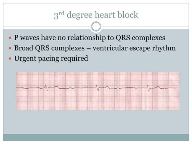 ECG basics by Dr.RISHI.pptx on studying the ecg | PPTX