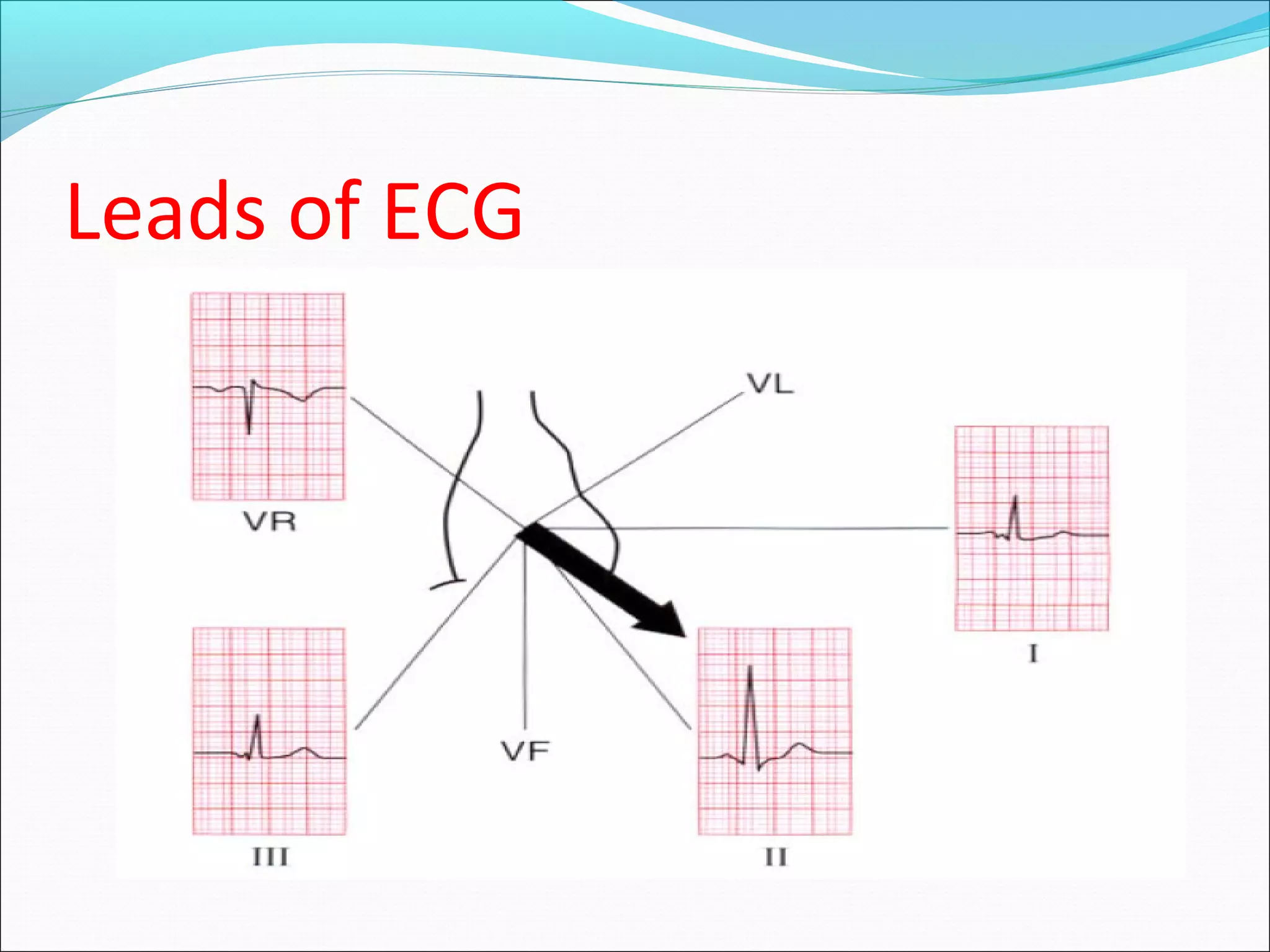 Ecg basics conduction tissue | PPT