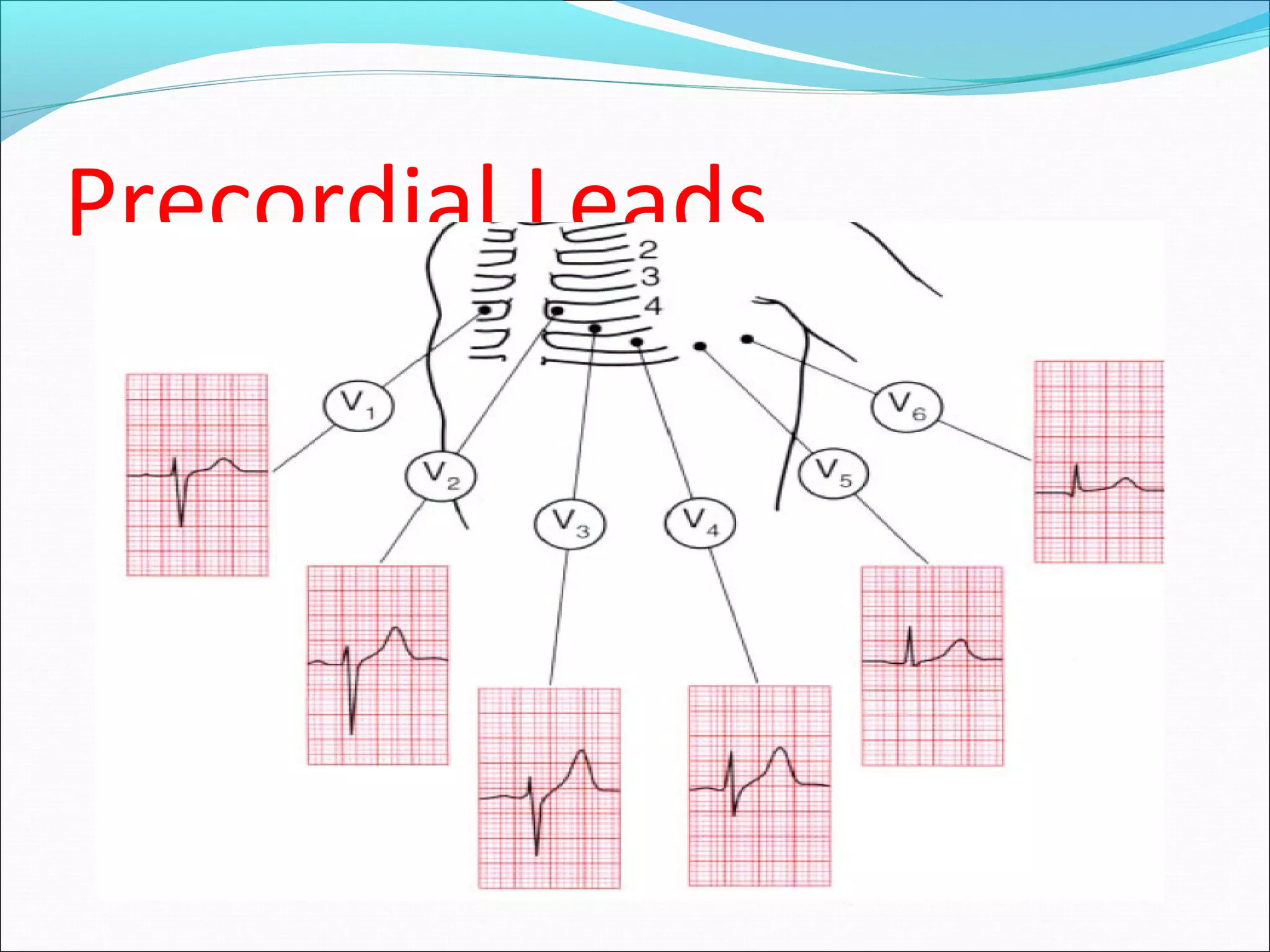 Ecg basics conduction tissue | PPT