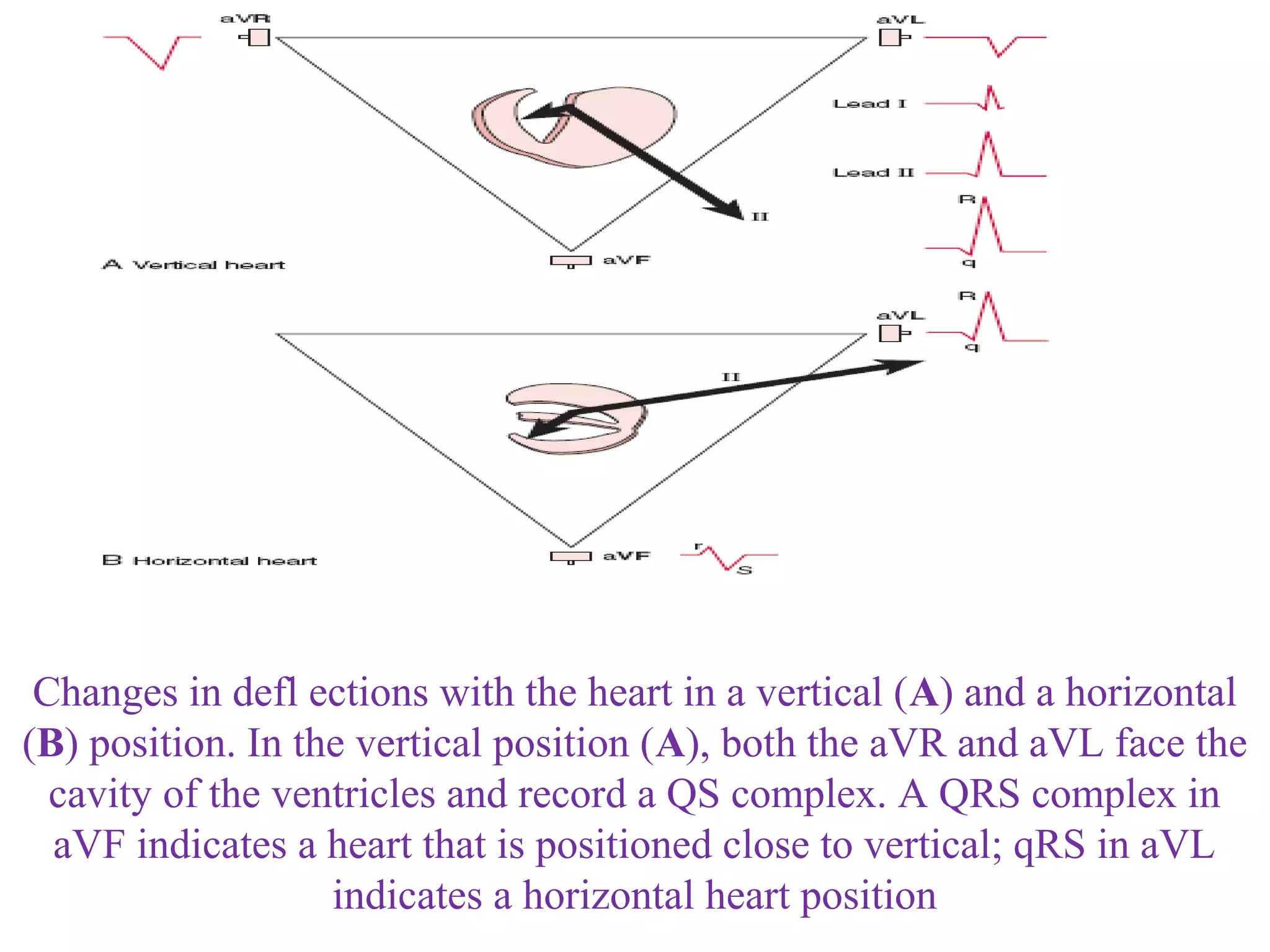 Ecg basics electric activity within heart | PPT