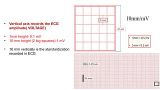 ECG basics finaaaaaaaaaaaaaaaaaaaaaaaaaaal.pptx