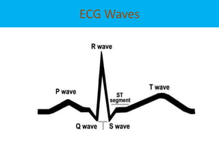 Electrocardiogaram - ECG EKG | PPTX