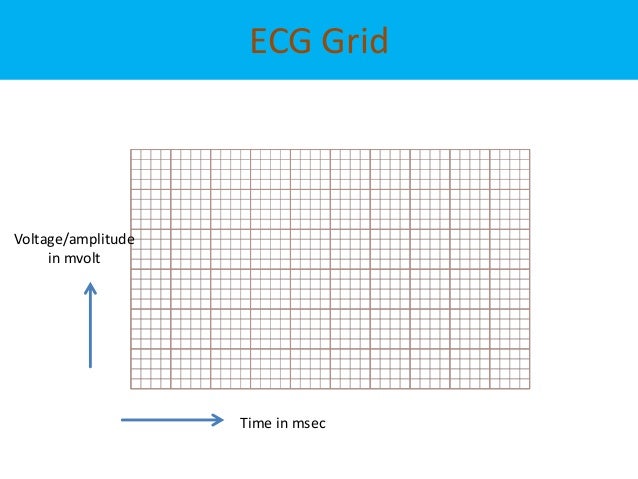 Electrocardiogaram - ECG EKG