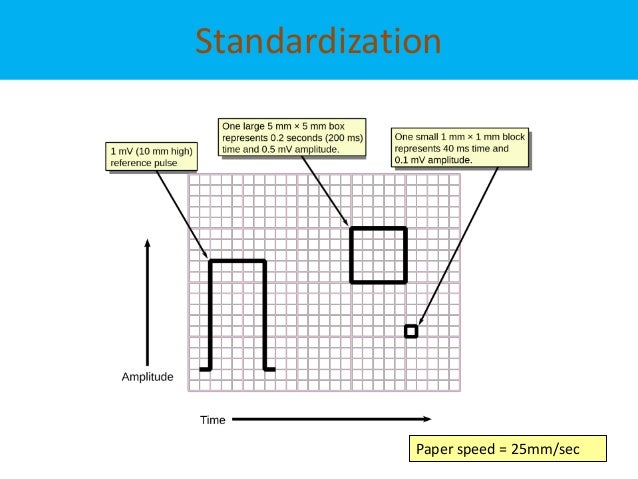 Electrocardiogaram - ECG EKG