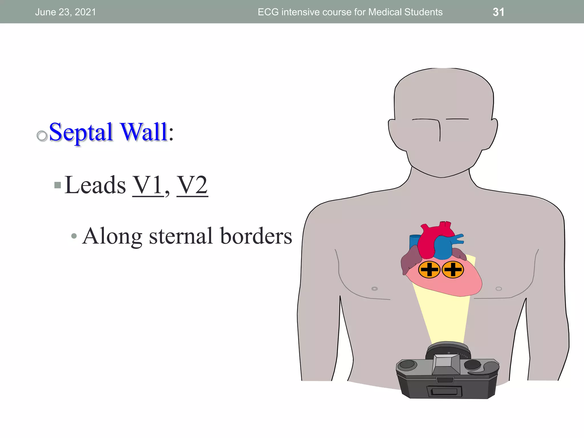 ECG Basics Lecture 2 | PPT