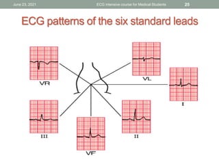 ECG Basics Lecture 2 | PPT