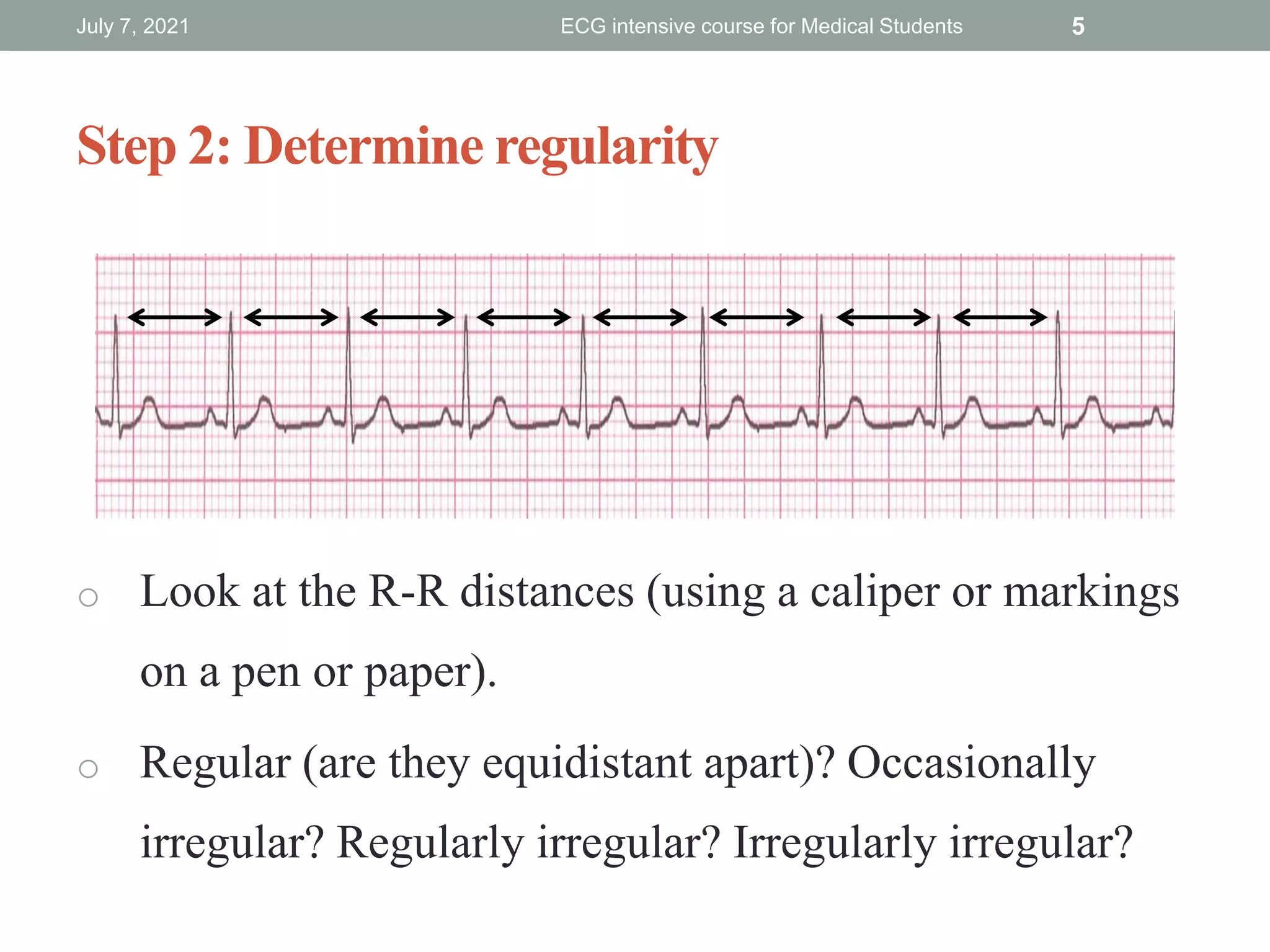 Ecg basics lecture 4 | PPT