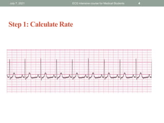 Ecg basics lecture 4 | PPT