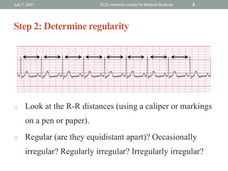 Ecg basics lecture 4 | PPT