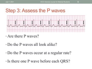 Ecg basics lecture 4 | PPT