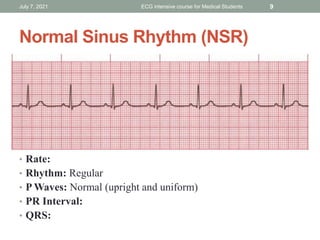 Ecg basics lecture 4 | PPT