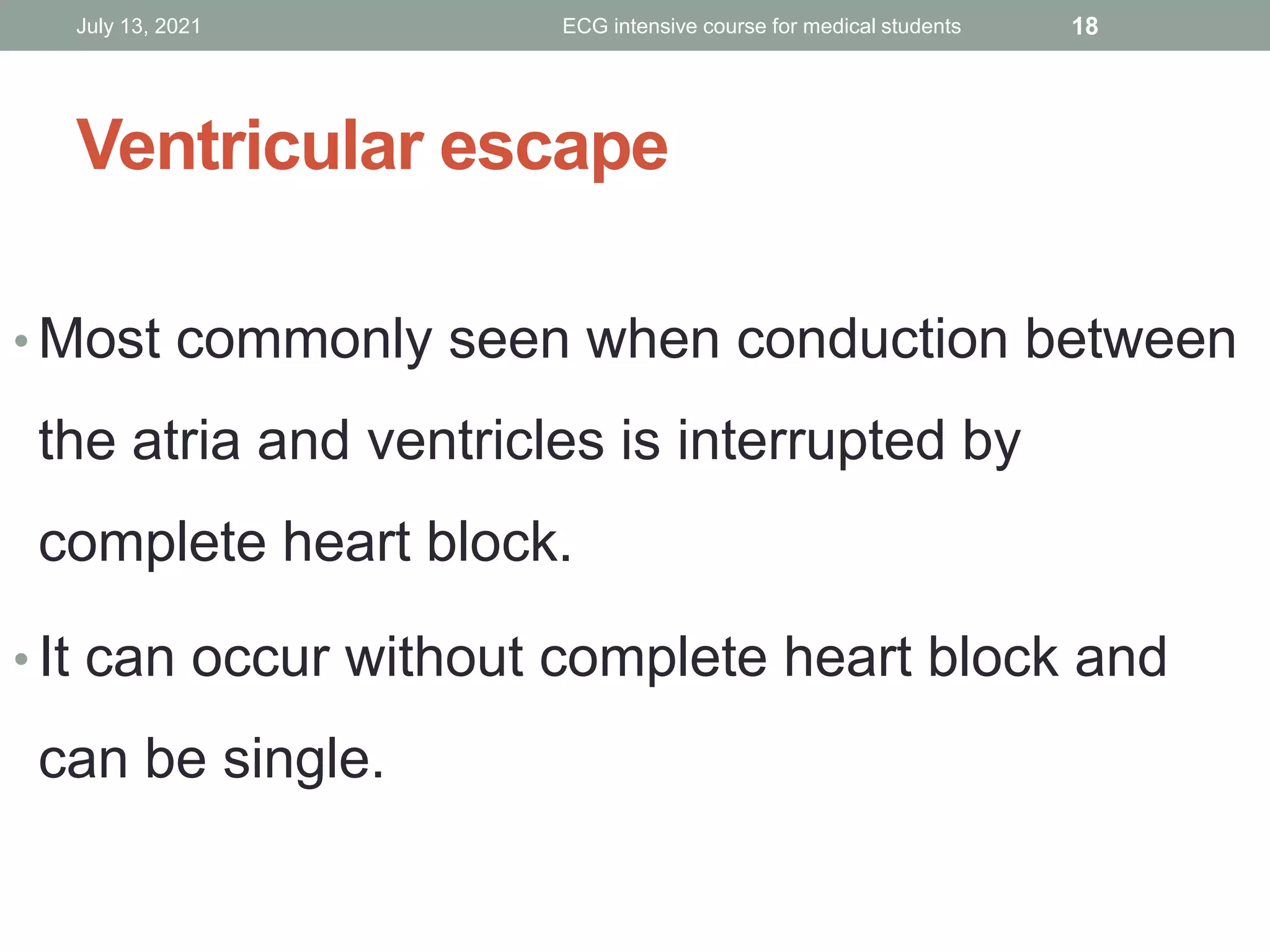 Ecg basics lecture 6 | PDF