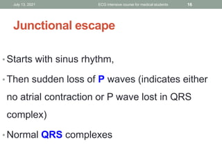 Ecg basics lecture 6 | PDF