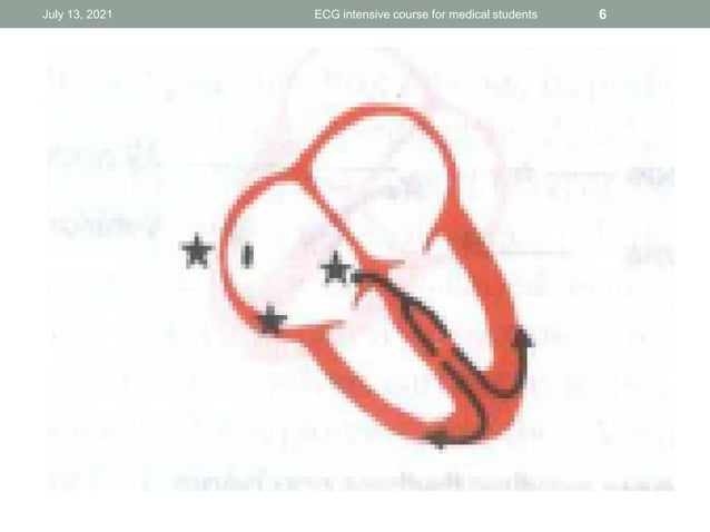 Ecg basics lecture 6 | PPT