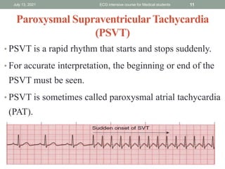 Ecg basics lecture 7 (The Last Lecture) | PPT