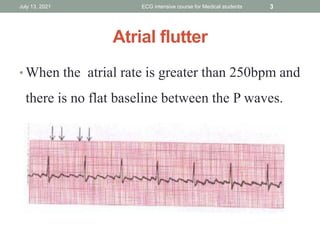 Ecg basics lecture 7 (The Last Lecture) | PPT