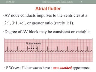 Ecg basics lecture 7 (The Last Lecture) | PPT