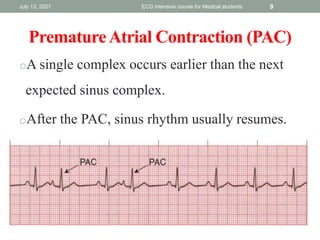 Ecg basics lecture 7 (The Last Lecture) | PPT
