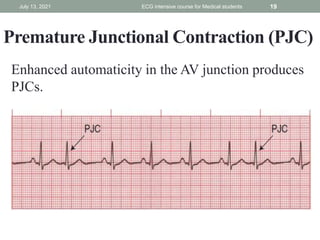 Ecg basics lecture 7 (The Last Lecture) | PPT