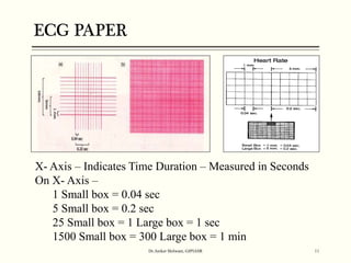 ECG BASICS | PPT