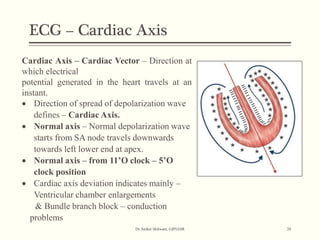 ECG BASICS | PPT