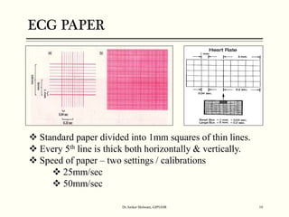 ECG BASICS | PPT