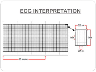 ECG BASICS physiology.ppt create by Muheeb | PPT