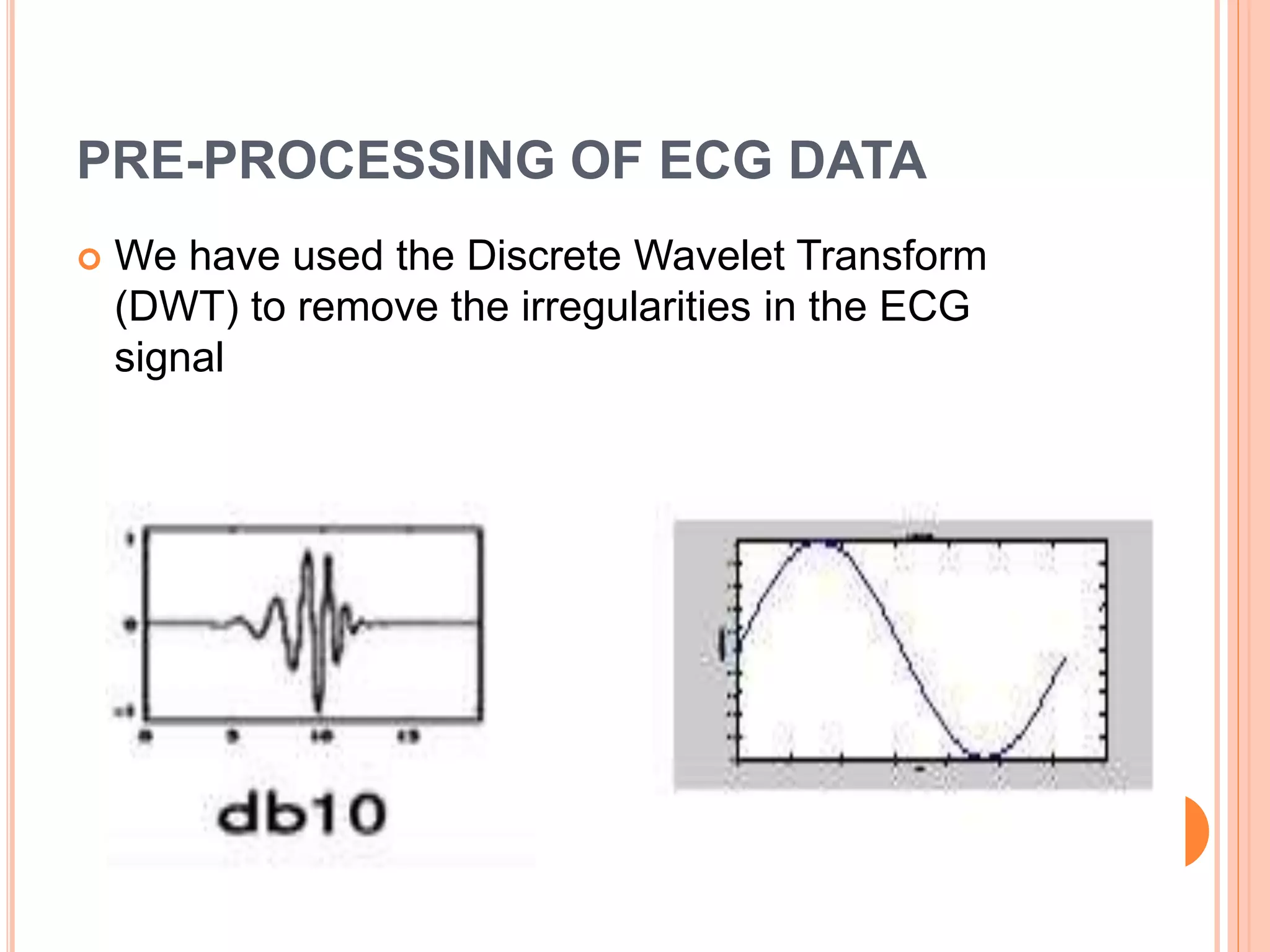 Ecg Beat Classification And Feature Extraction Using Artificial Neural