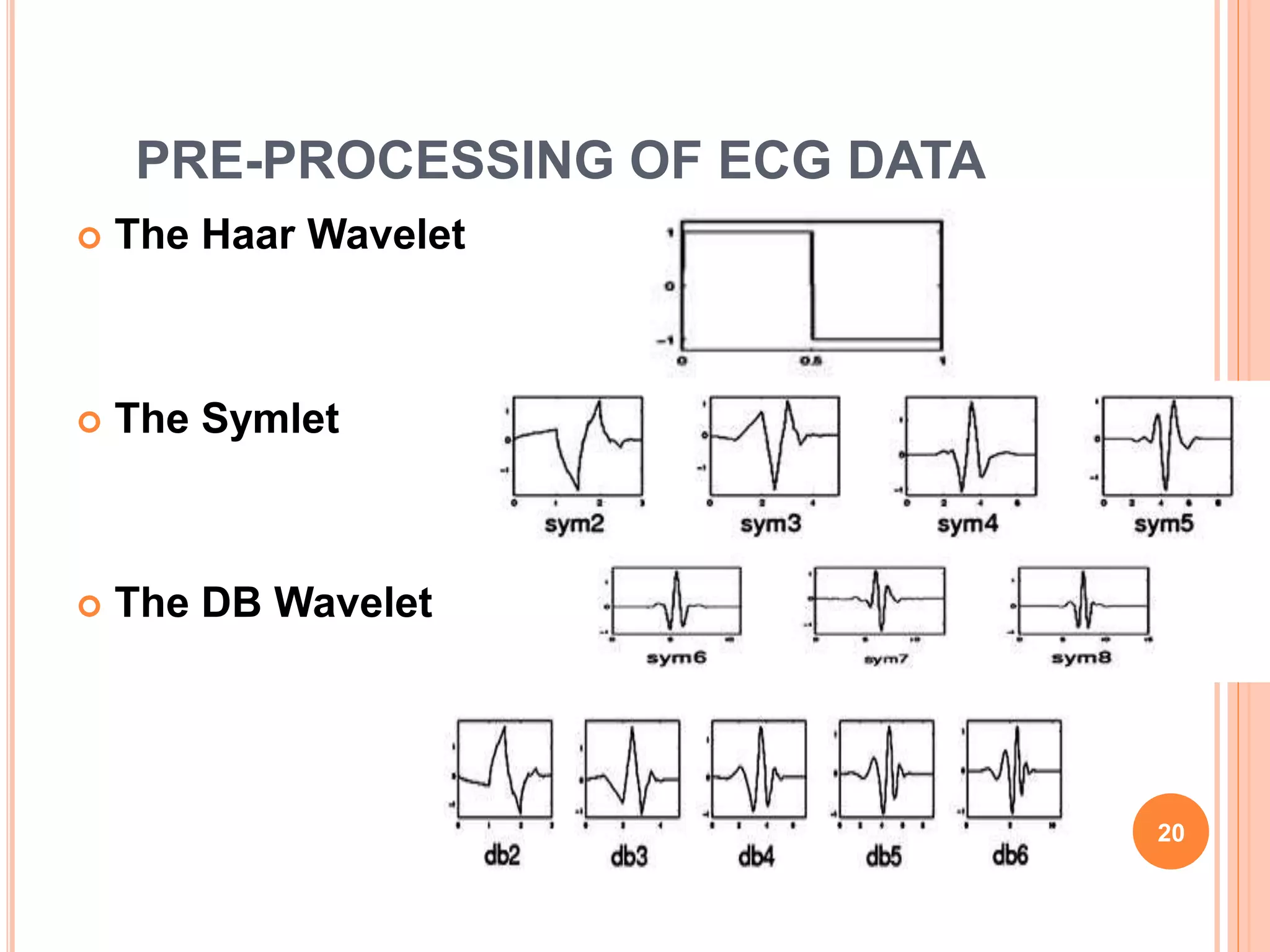 Ecg Beat Classification And Feature Extraction Using Artificial Neural
